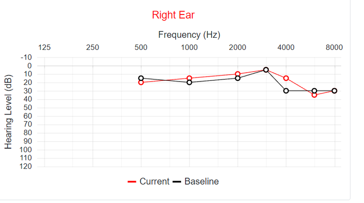 Benson Cloud Services — Benson Medical Instruments | Audiometer ...