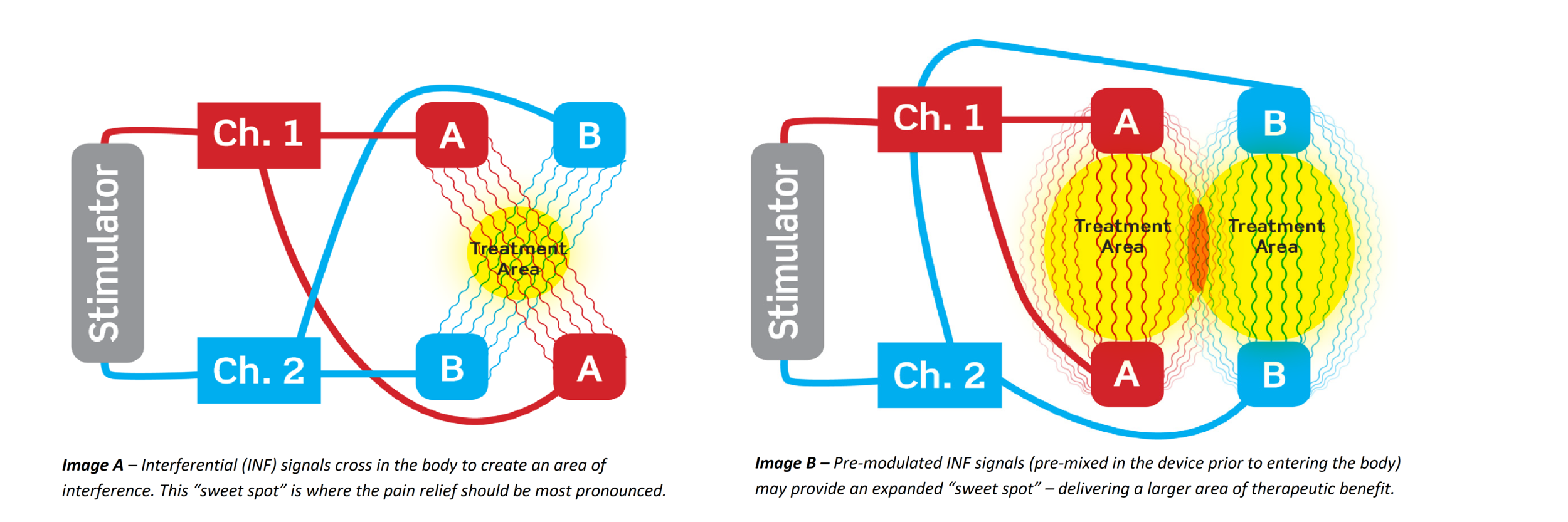 How to Compare TENS Units – A Review of Price & Performance — RS Medical