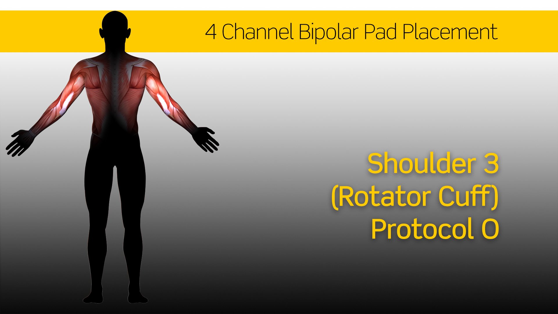 Shoulder & Arm Placement Videos — RS Medical