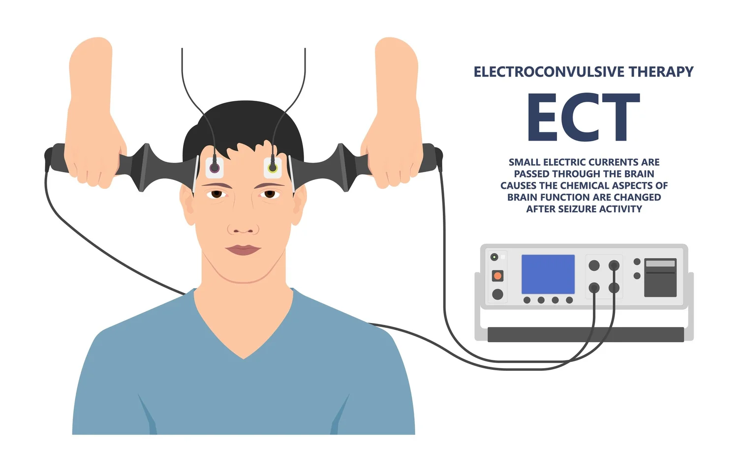 Revisiting Electroconvulsive Therapy - Part 1 — Gordon Corsetti Mental ...