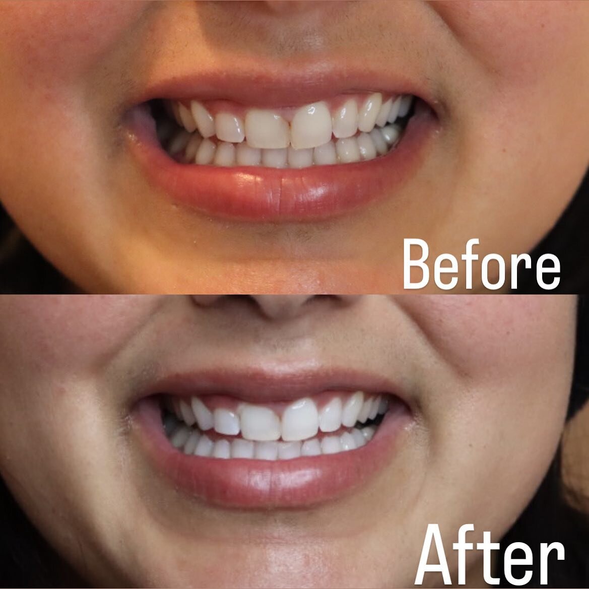 Mist Fine Airbrush Tanning