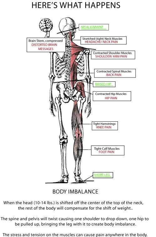 Biggest Stressor on the Human Body? — NUCCA Upper Cervical Chiropractic ...