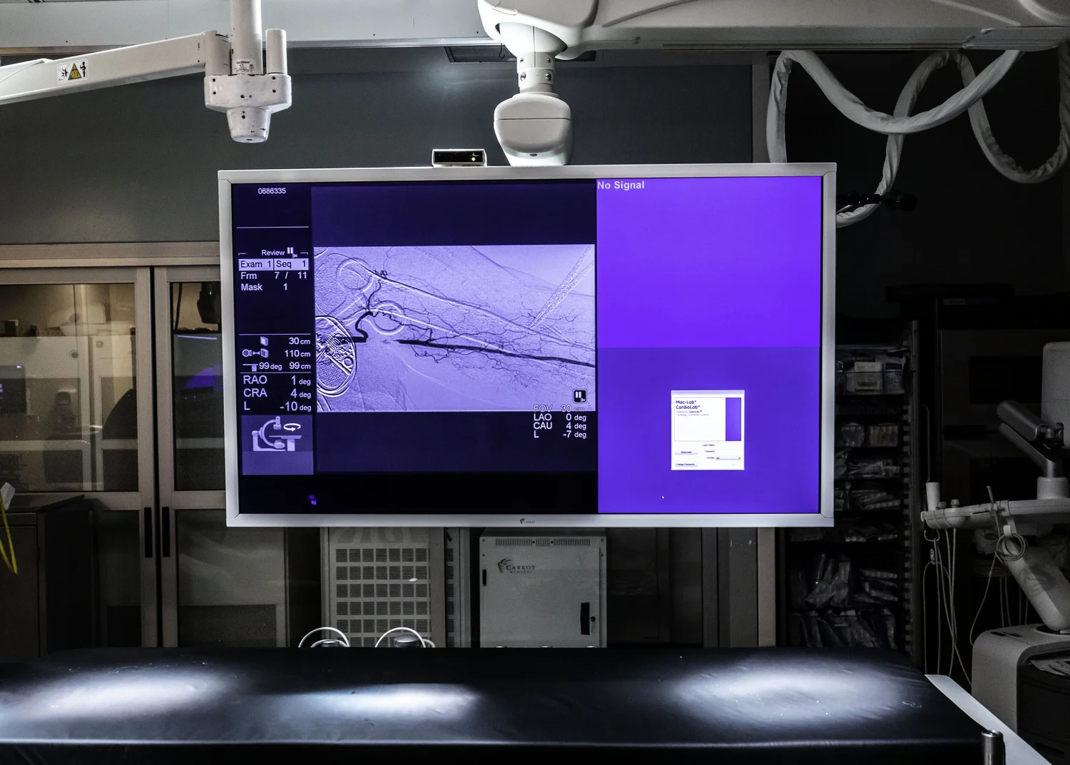 C-View Large Medical Display for Cath and EP Labs — Carrot Medical