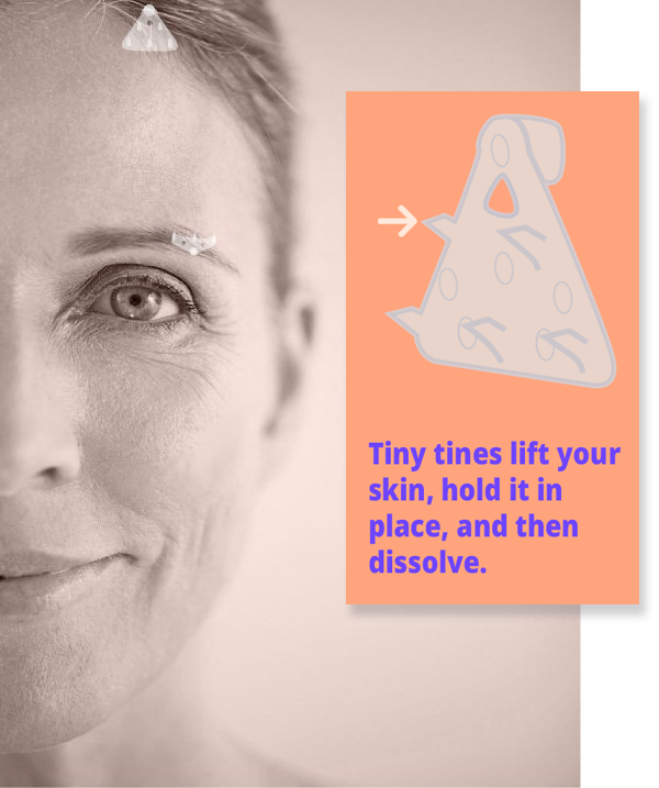 Endotine Surgery | Do you qualify for brow lift surgery? | Endotine®