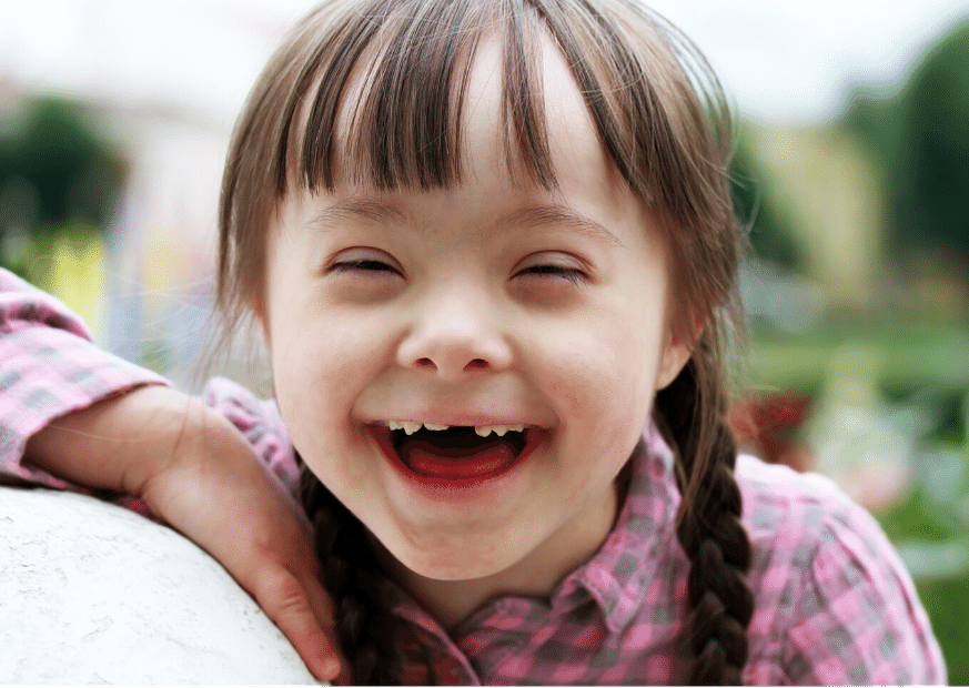 Down Syndrome