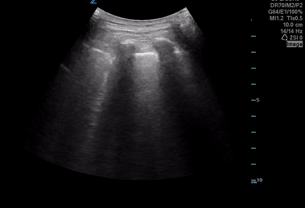 COTW 10/9/22 55 yo male presenting with shortness of breath — Kaiser ...