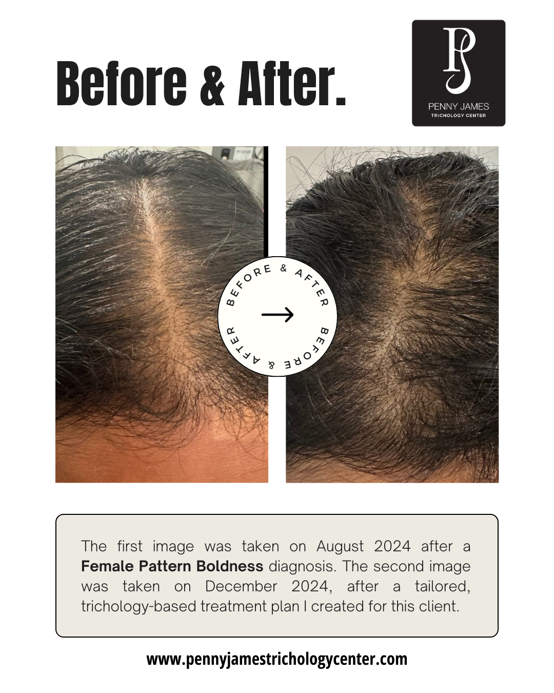 What is a Trichologist? Hair and Scalp Experts | Penny James Trichology ...