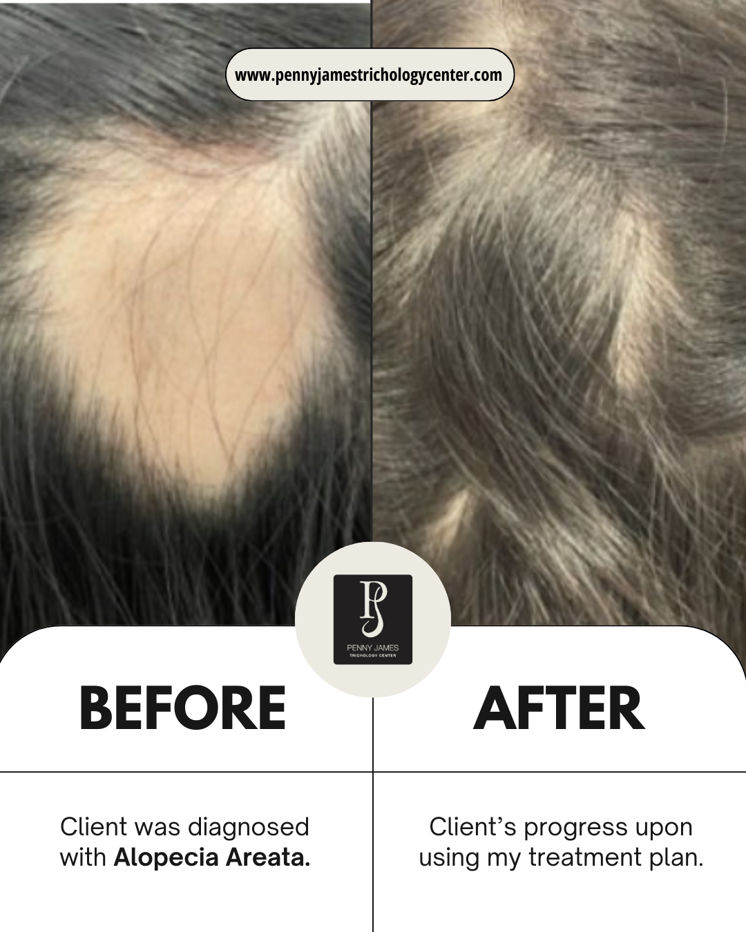 What is a Trichologist? Hair and Scalp Experts | Penny James Trichology ...