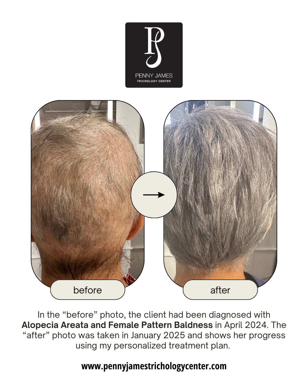 What is a Trichologist? Hair and Scalp Experts | Penny James Trichology ...