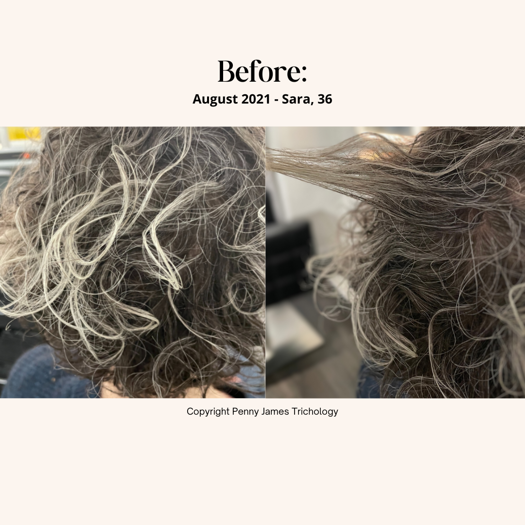Hair Pigmentation Changes | Penny James Trichology | NYC