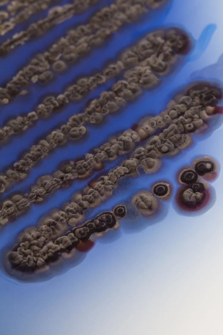 From Bacteria to Colour: the Organic Method of Textile Dyeing — Plural