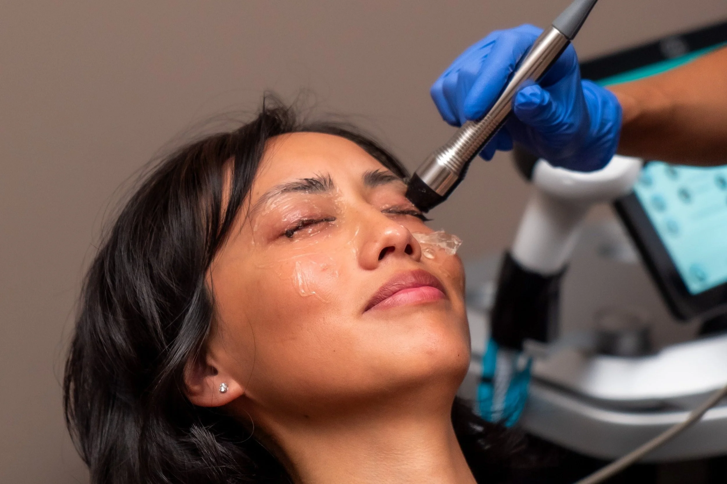 Eye & Skin Rejuvenation — Today's Vision - Grand Morton