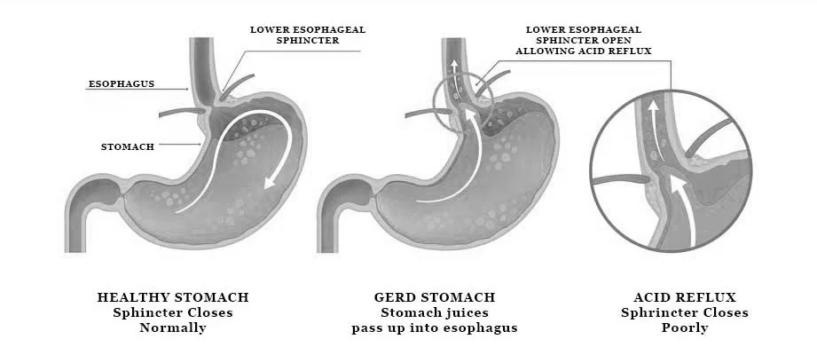 Illinois Center for Digestive and Liver Health
