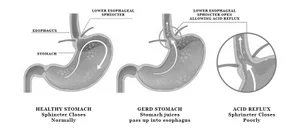 Illinois Center for Digestive and Liver Health