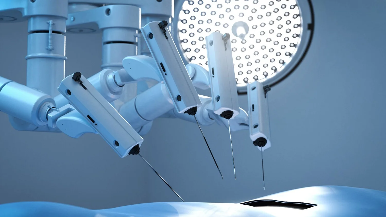 Understanding Robotic Assisted Surgical Systems (RAS) in India ...
