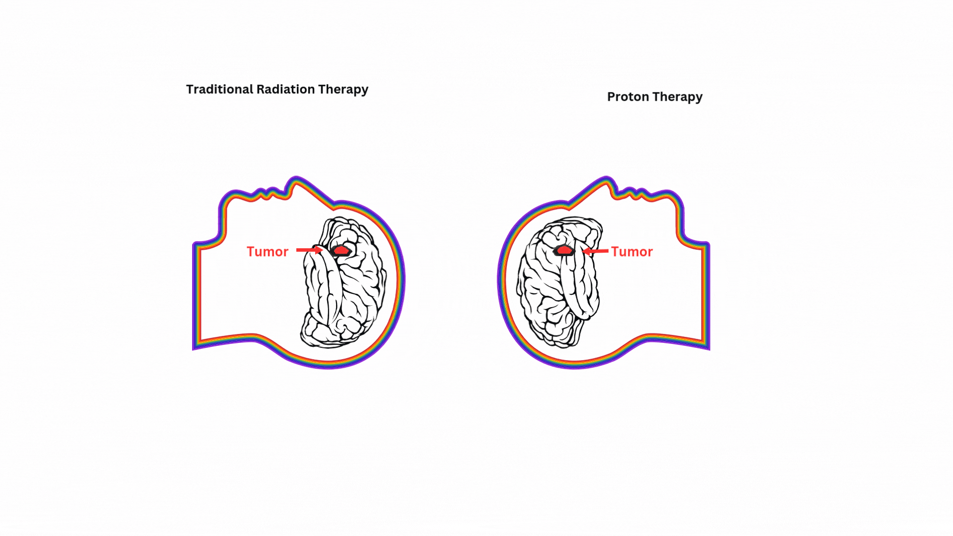 Precision Cancer Treatment: The Power Of Protons — Healthcare Executive