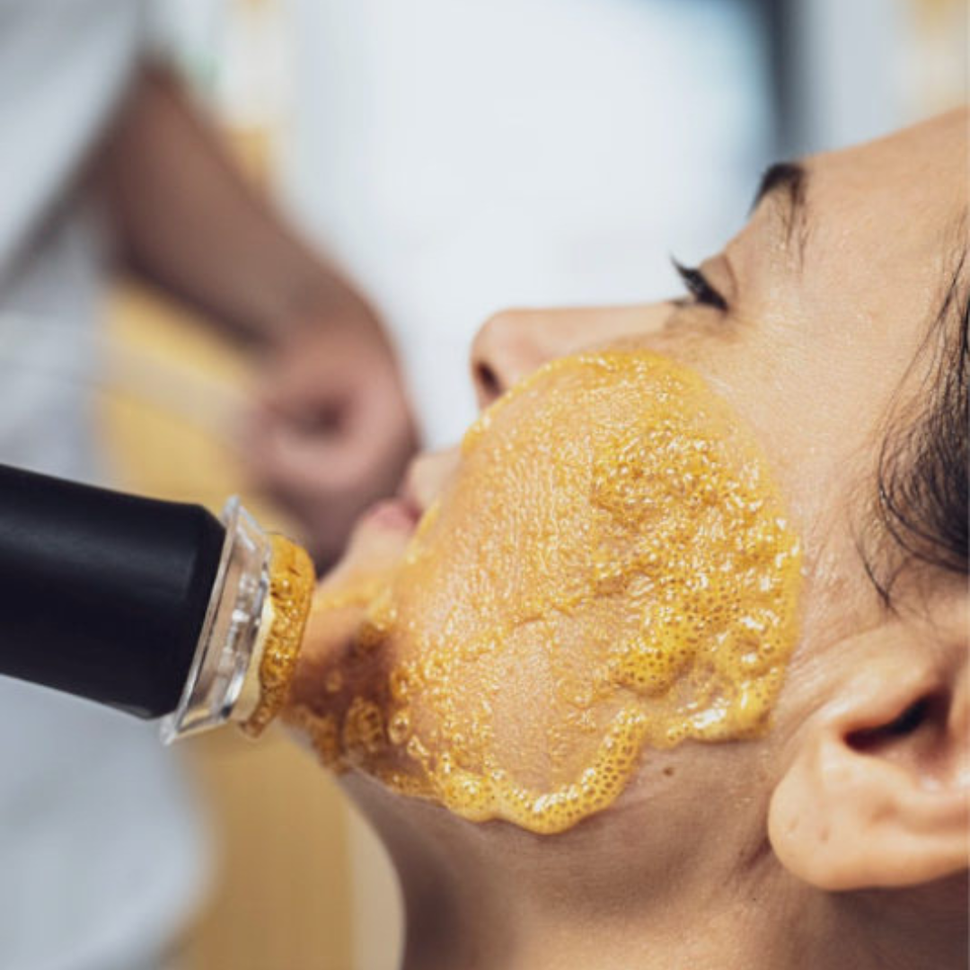 Geneo Glam Gold Facial | Treats and Prevents Signs of Ageing