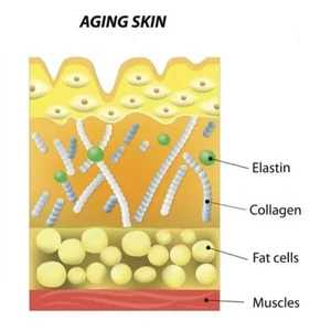 Cellulite: what is it and what can do you do about it? — LondonCryo