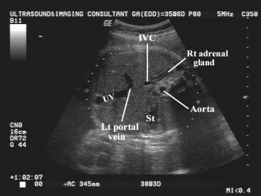 Obstetrical Ultrasound — CREOGS Over Coffee