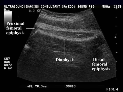 Obstetrical Ultrasound — CREOGS Over Coffee