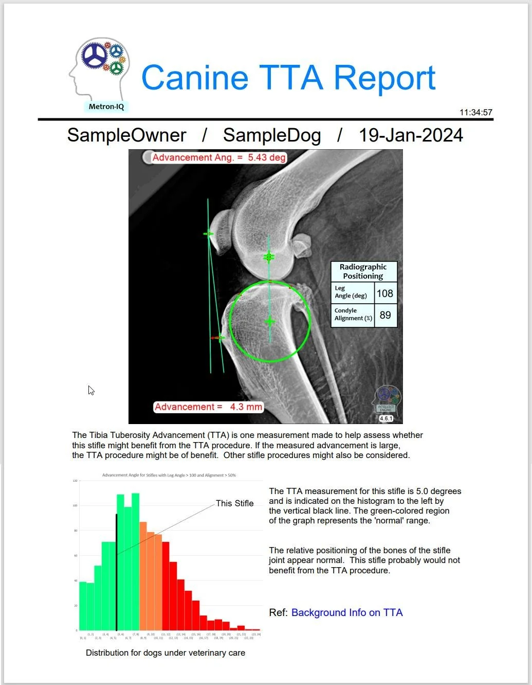 Metron-IQ — MetronMind