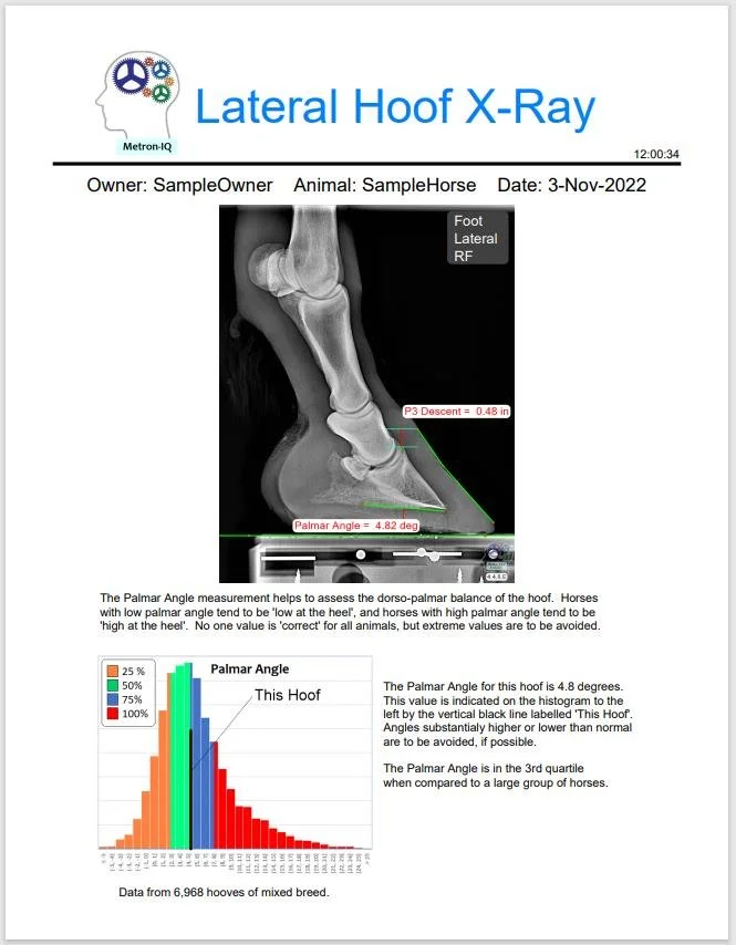 Metron-IQ — MetronMind