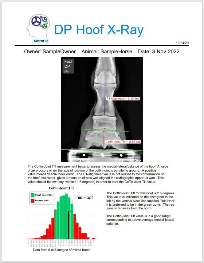 Metron-IQ — MetronMind