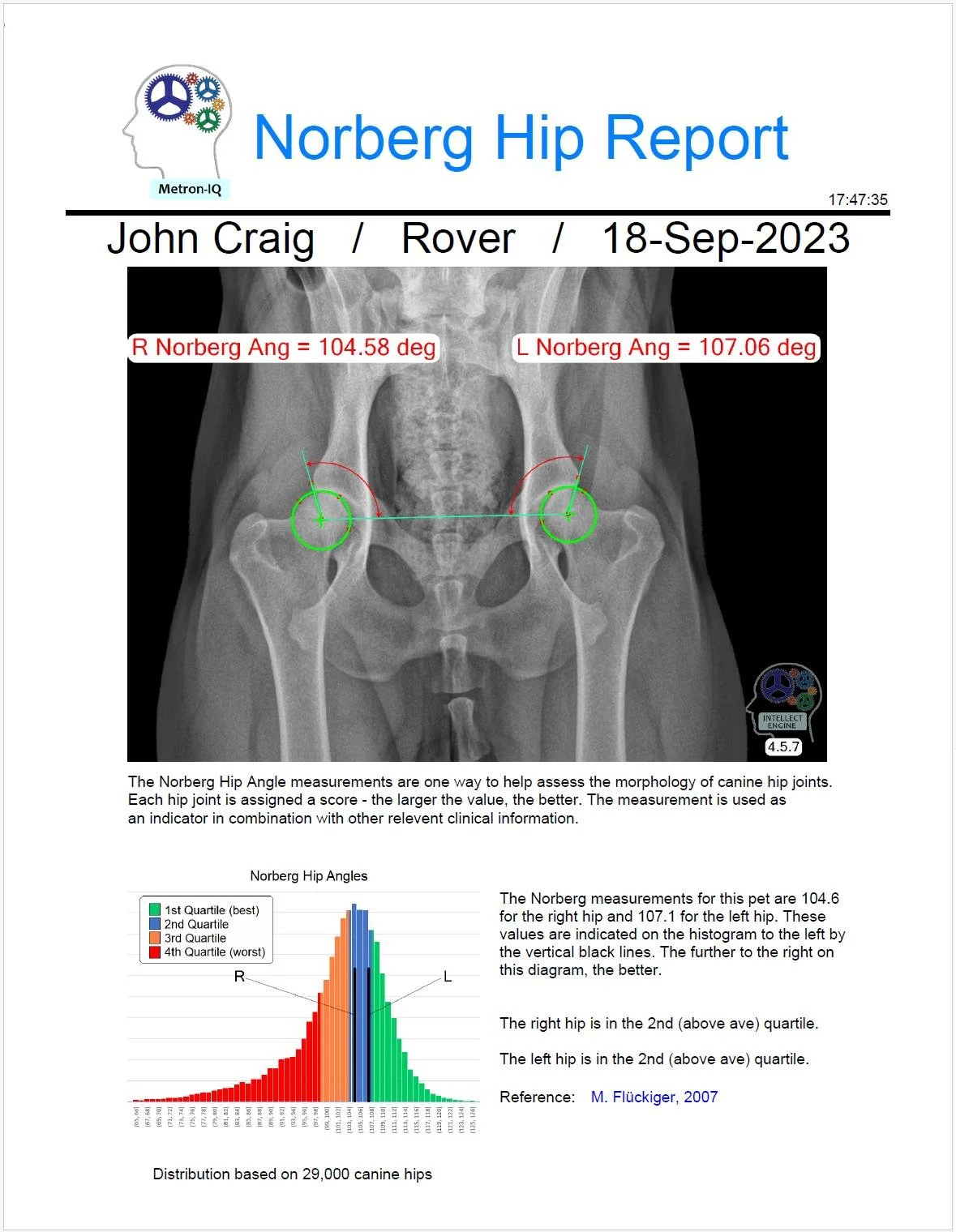 Metron-IQ — MetronMind