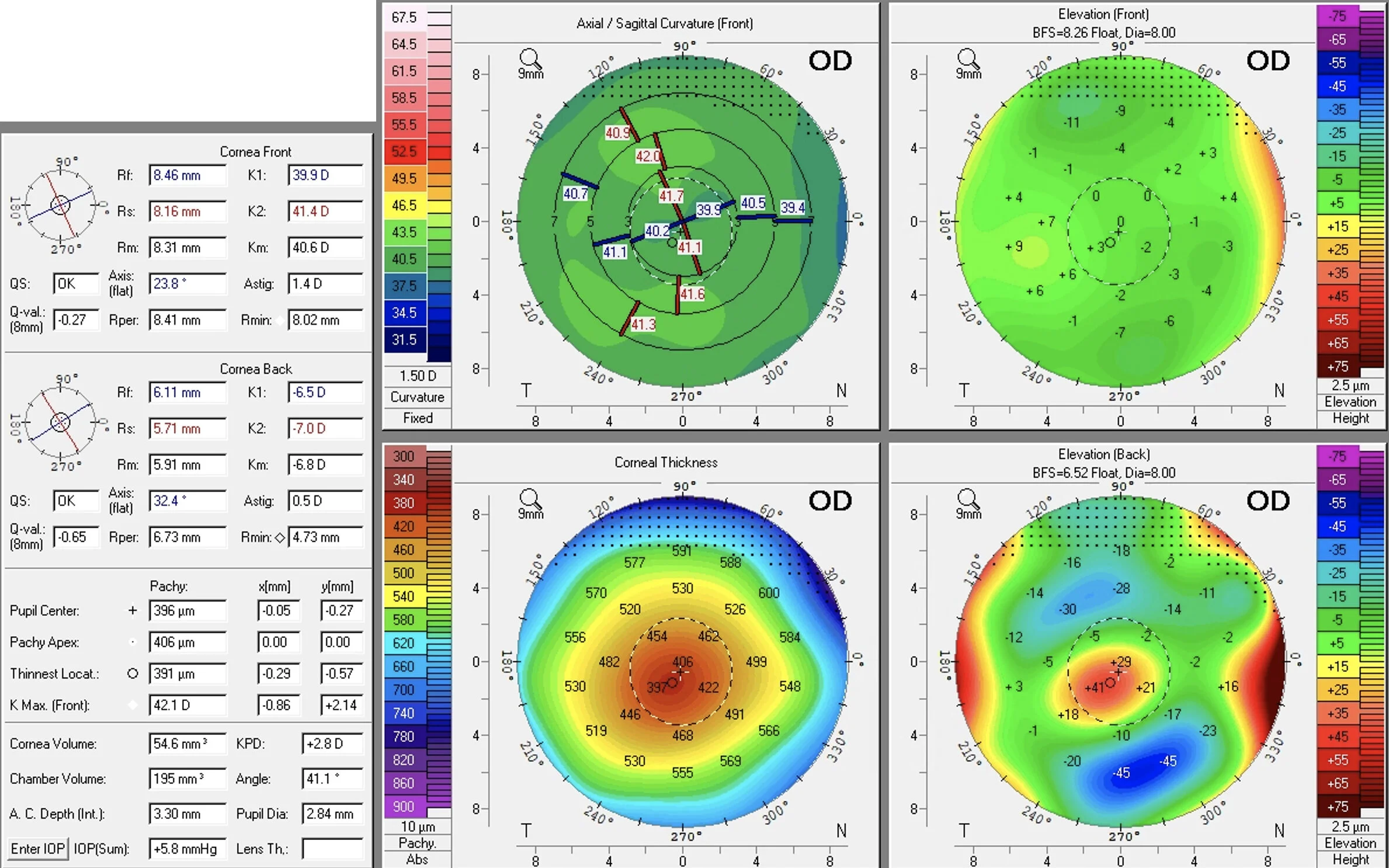 Advanced Keratoconus Treatment Brisbane — Dr David Gunn · Brisbane ...