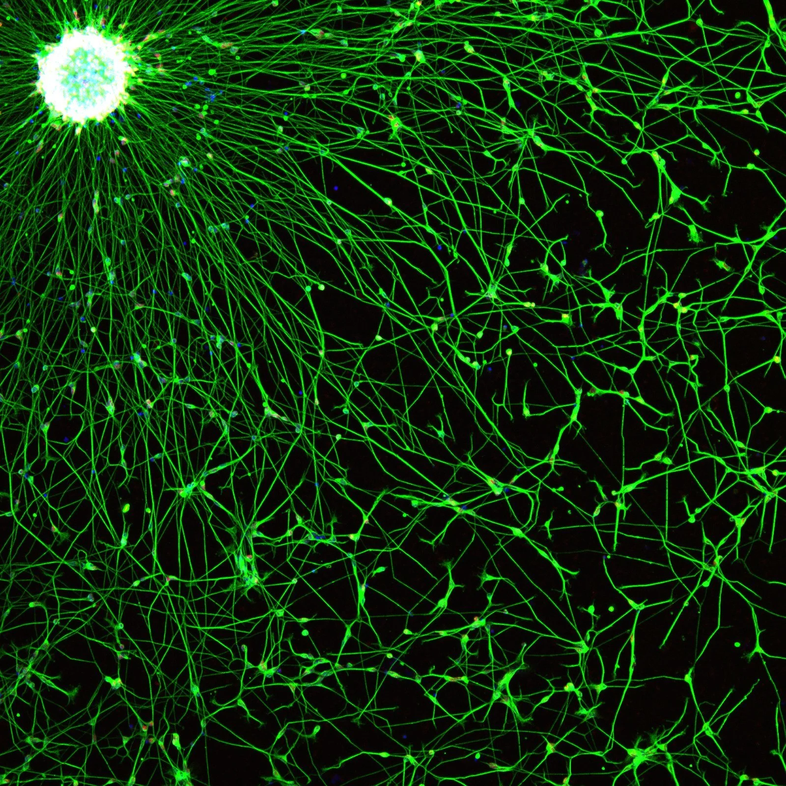 MuSC Mechanobiology — The Gilbert Lab