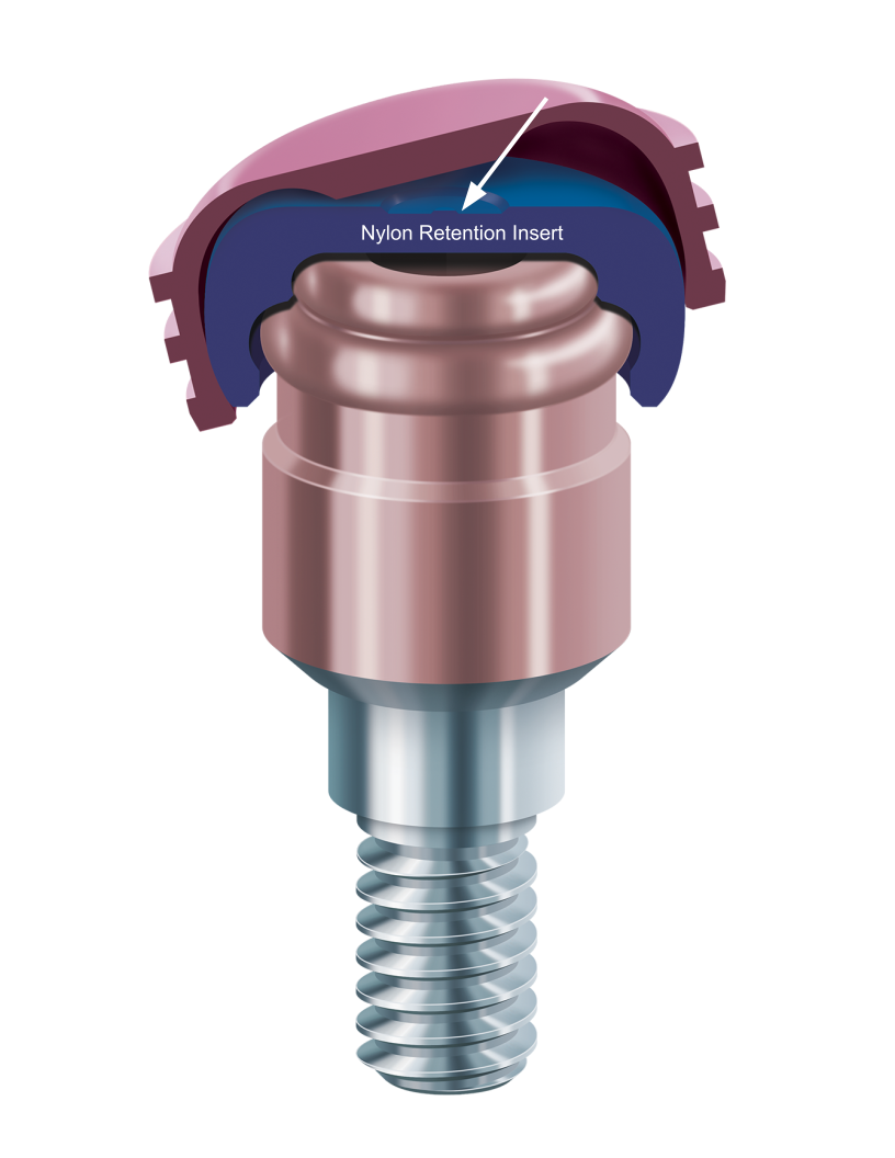 Locator Dental Coding — Harbor Dental | Point Loma | San Diego