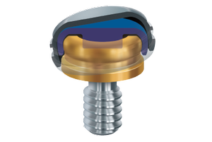 Locator Dental Coding — Harbor Dental | Point Loma | San Diego