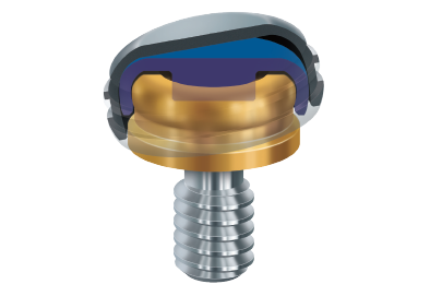 Locator Dental Coding — Harbor Dental | Point Loma | San Diego