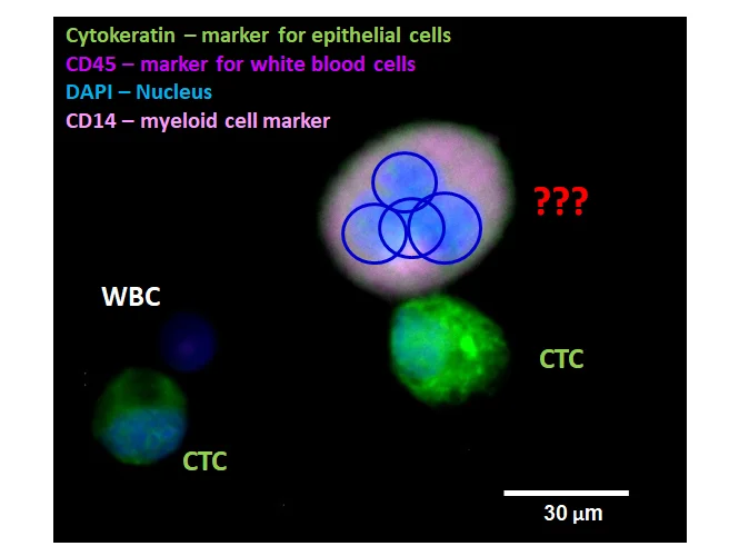 Liquid Cell Biopsy — Creatv BIO