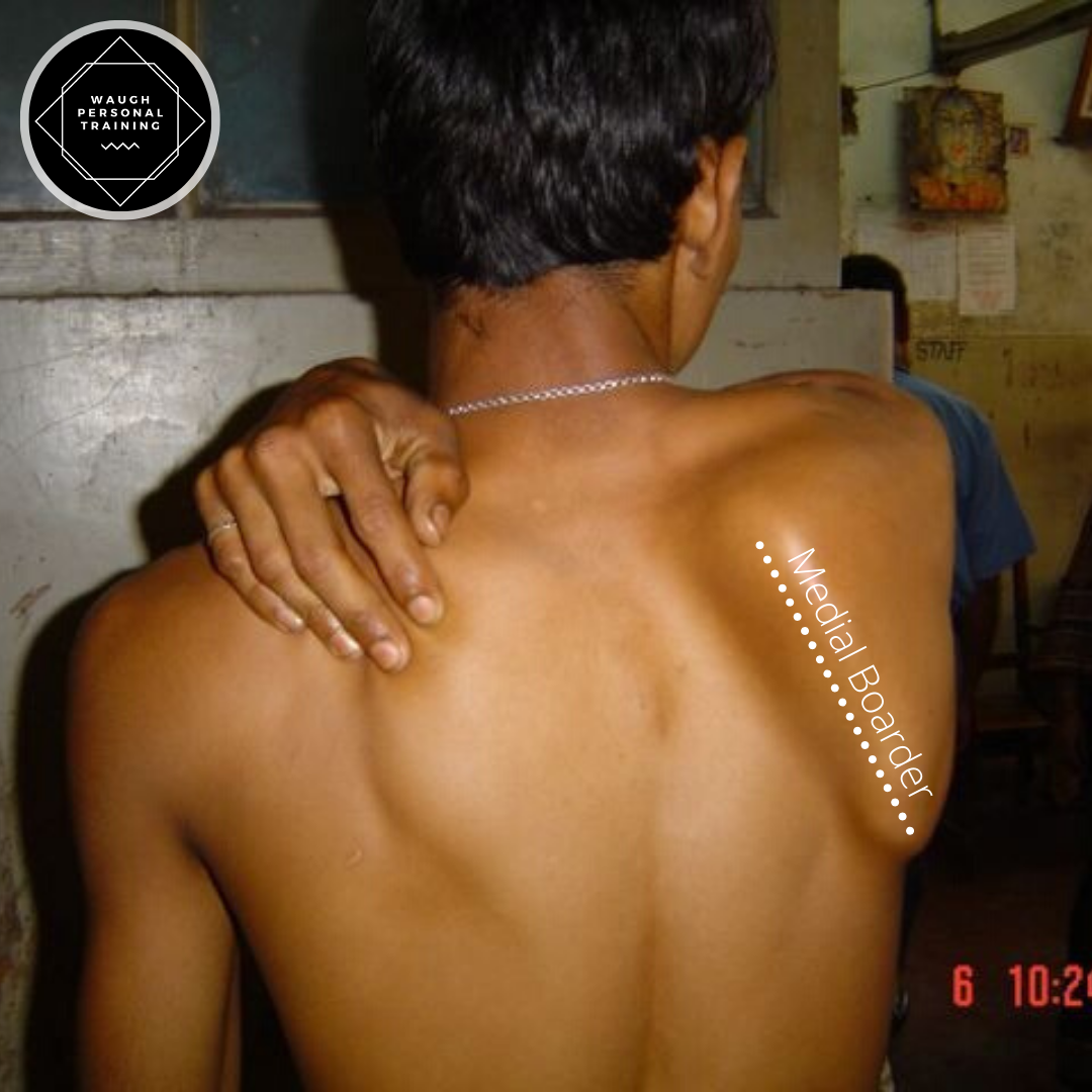 Scapular Winging - How To Fix Your Asymmetries — Waugh Personal Training
