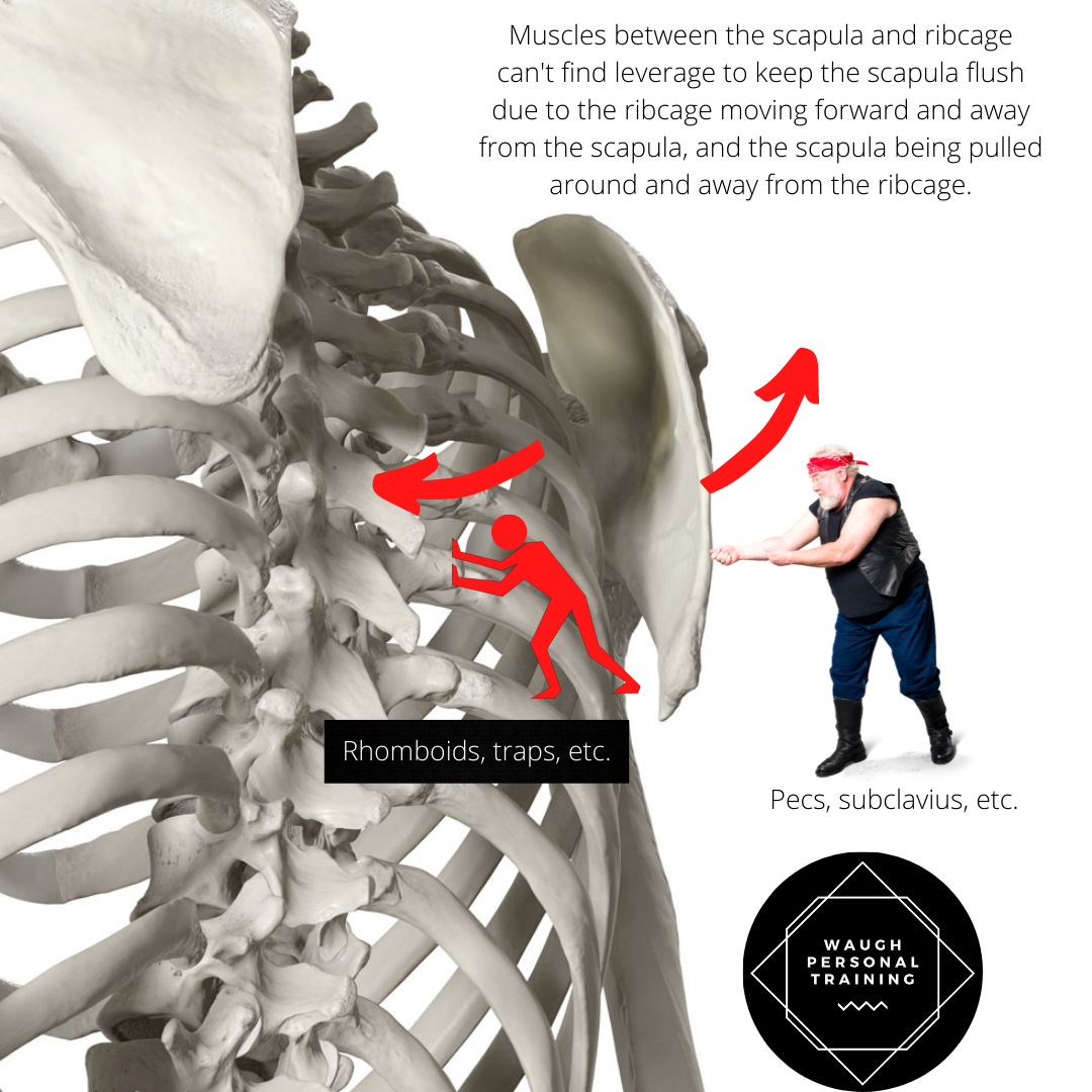 Scapula Winging Causes | Scapular Winging: Symptoms, Causes, and ...