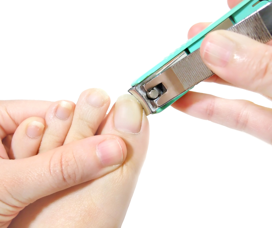 Try This When Trimming Toenails — PodiatryCare, P.C. and the Heel Pain ...