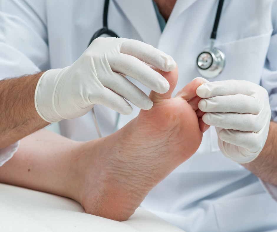 5 Common Foot and Ankle Cysts — PodiatryCare, P.C. and the Heel Pain Center