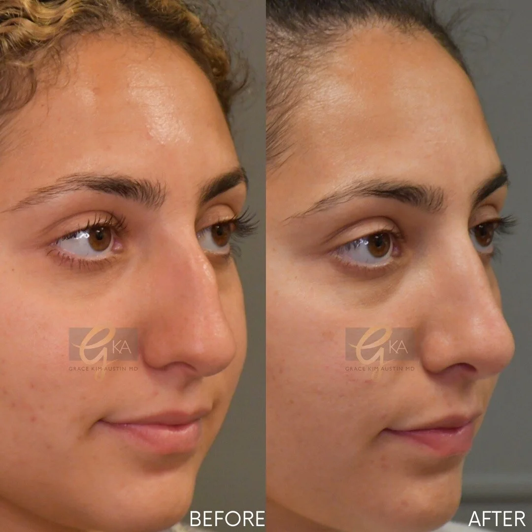 Gallery | See Transformation Results — Book a Consultation — Facial ...