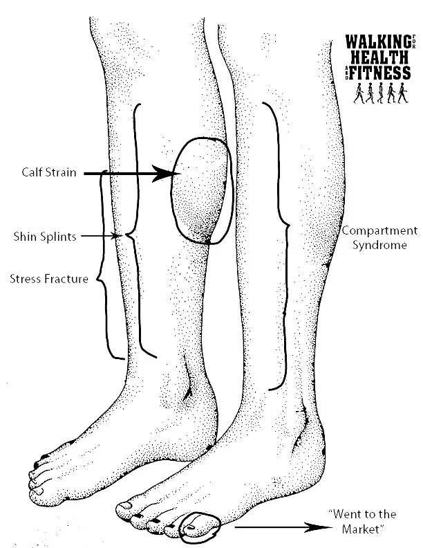 How to Treat Lower Leg Pain at Home