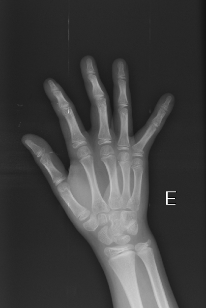 Ortho Case: Finger Injury — Kwak Talk