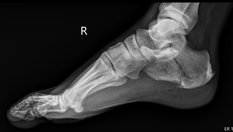 Ortho/Trauma Case: Jumper - Fall from Height — Kwak Talk
