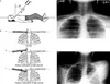 Sternoclavicular Joint Dislocation — Kwak Talk