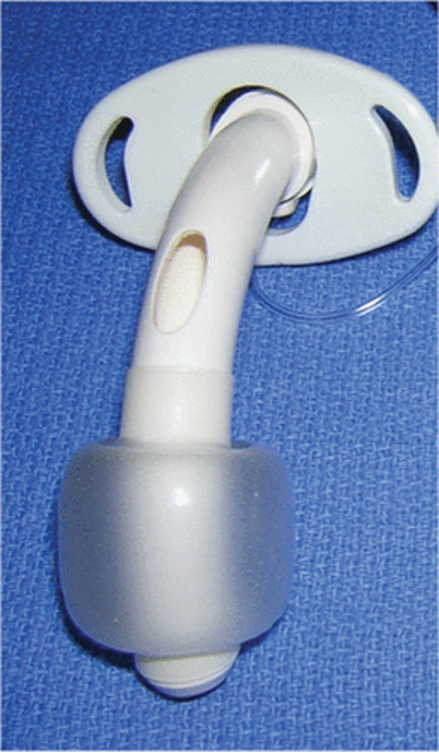 Tricks of the Trach — Kwak Talk