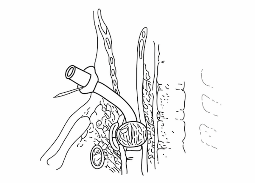Tricks of the Trach — Kwak Talk