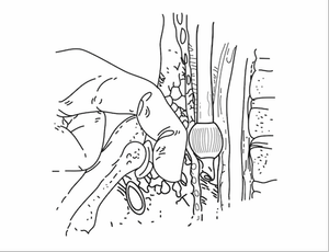 Tricks of the Trach — Kwak Talk