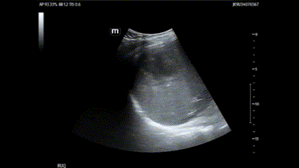Hepatic Mass — Kwak Talk