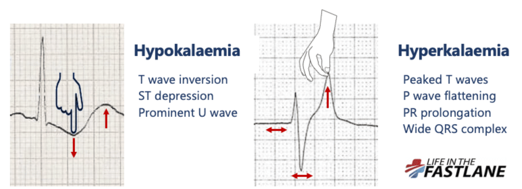 Analysis of Paralysis — Kwak Talk