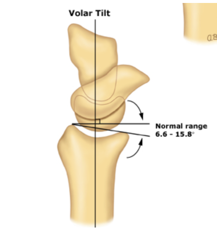 Distal Radius Fractures and Splinting — Kwak Talk