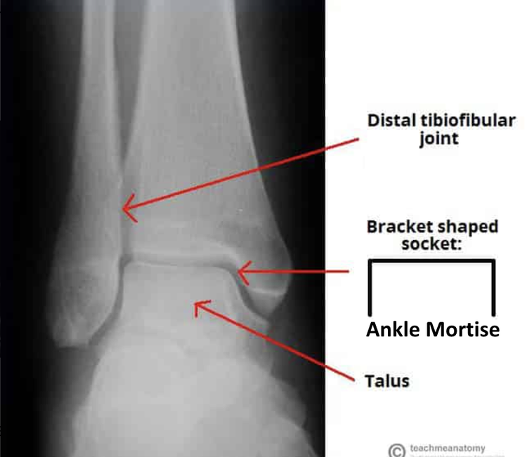 Ankle Fractures — Kwak Talk